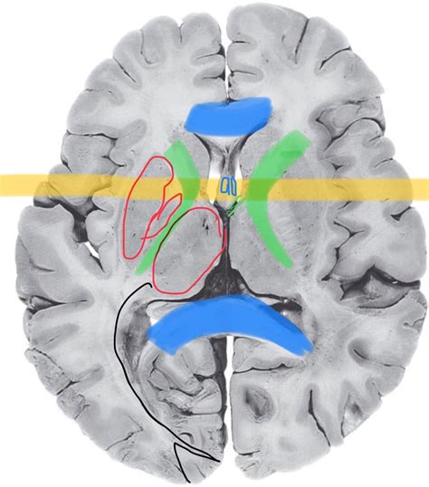 Brain Slice Diagram Quizlet