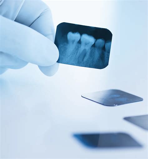 Radiografia Periapical Entenda O Que E Como Funciona Esse Exame Em