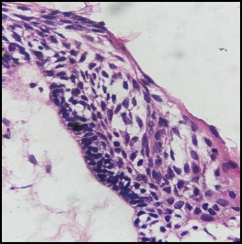 H And E Stained Section 100x Fig 5 H And E Stained Section 400X