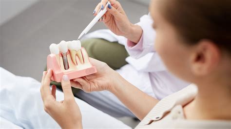 Cuidado De Implantes Dentales 7 Consejos Para Cuidar Tus Implantes