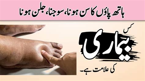 Numbness Tingling Of Hands And Feet Hath Pao Ka Sun Hona Soojna