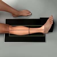 Radiographic Positioning Of The Femur And Tib Fib CE4RT