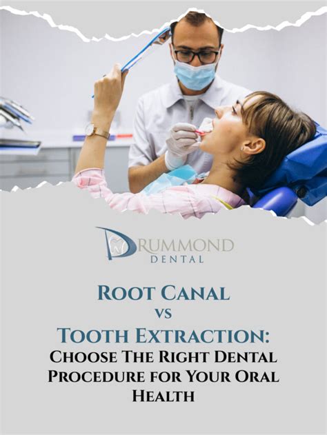 Root Canal Vs Tooth Extraction Choose The Right Dental Procedure For