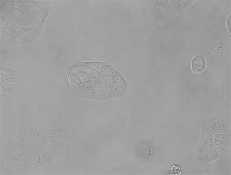 Phase Contrast And Microscopy Science Lab Leica Microsystems