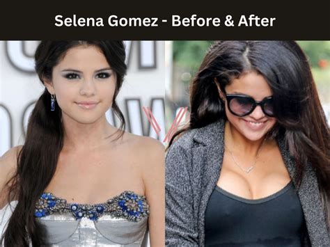 Celebrities With Breast Implants Before After Photos Vantage