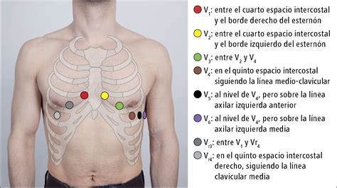 Posições Dos Eletrodos Para Ecg RETOEDU