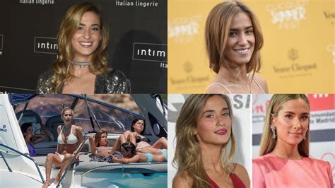 El antes y el después de María Pombo su paso por quirófano le marcó