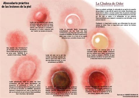 Resumen práctico lesiones de la piel Fuente Dr Augusto Saldaña