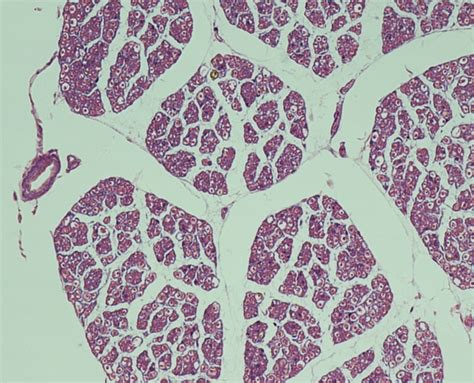 Lab Nerve Cross Section Histology Diagram Quizlet