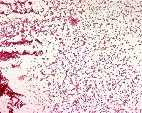 Gram Negative Coccobacillus
