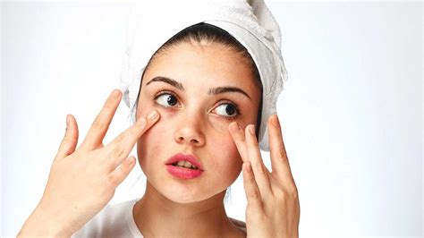 7 Cara Mengatasi Kulit Kering Dan Kusam Secara Alami