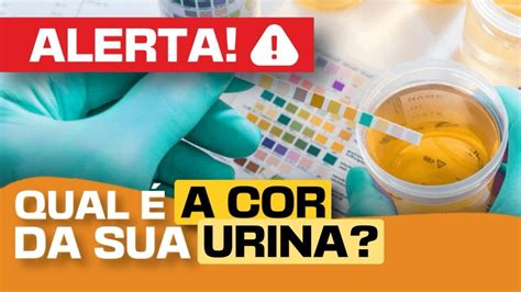 O QUE A COR DA SUA URINA REVELA SOBRE A SUA SAÚDE Saúde e Equilíbrio