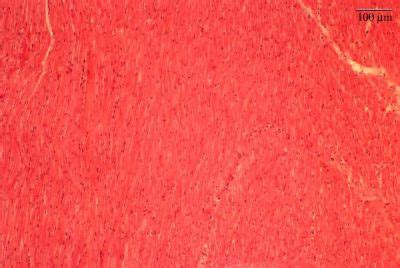 Cardiac Muscle Histology Cardiac Muscle Histology Slide