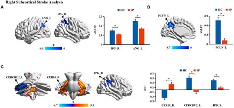 frontiers alterations of dynamic and static brain functional activities and integration in