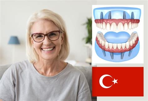 Full Mouth Dental Implants Package Deals In Turkey