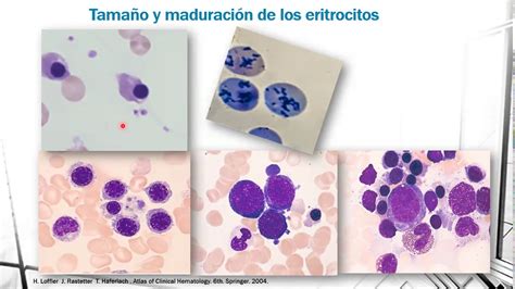 Alteraciones de células sanguíneas YouTube