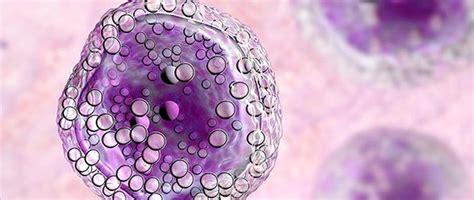 Mosunetuzumab Rimborsabile Per Il Linfoma Follicolare