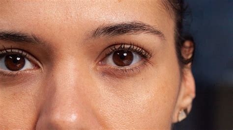 Retinopatía Diabética Causas Síntomas y Tratamientos Instituto