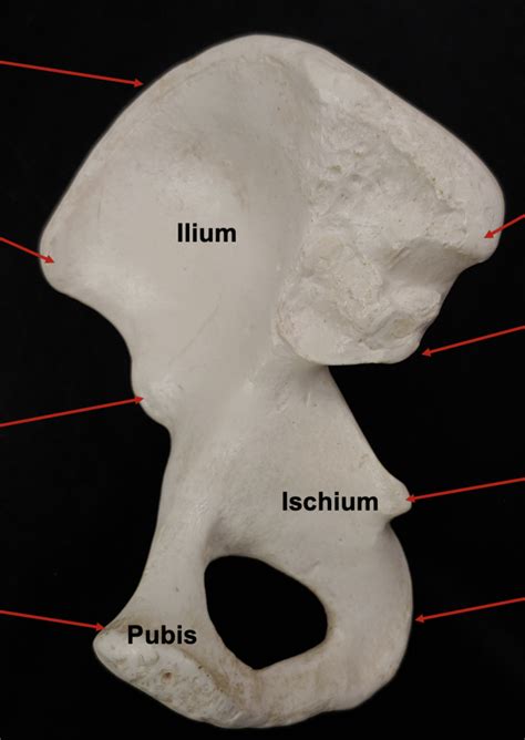 Innominate Bone R Medial Diagram Quizlet