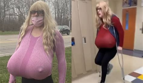Canadian Teacher With Size Z Prosthetic Breasts Is Placed On Paid Leave