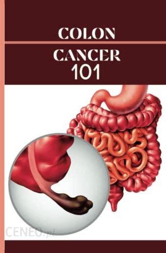 COLON CANCER 101 The Perfect Guide To Understanding The Causes