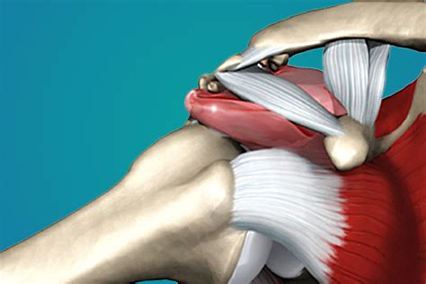 Pinzamiento Subacromial Orthotrauma Perú