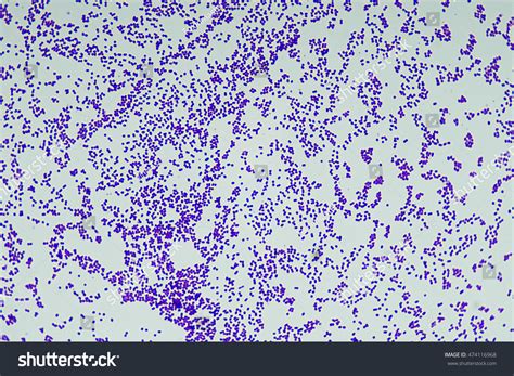 Cocci Bacteria Shape