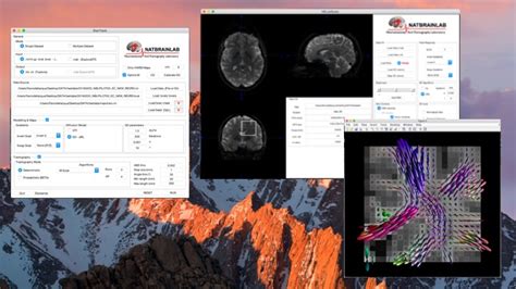 toolbox image processing image processing toolbox matlab