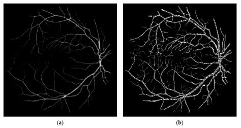 symmetry free full text parallel raster scan for euclidean distance transform