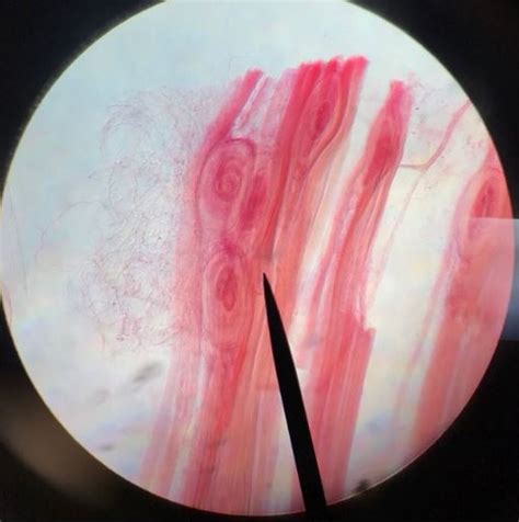 BY 341 Parasitology Exam Three Practical Flashcards Quizlet