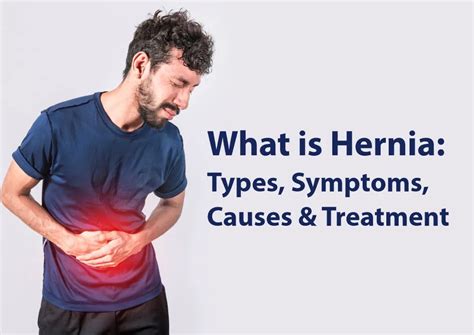 Hernia Types Symptoms Causes Treatment