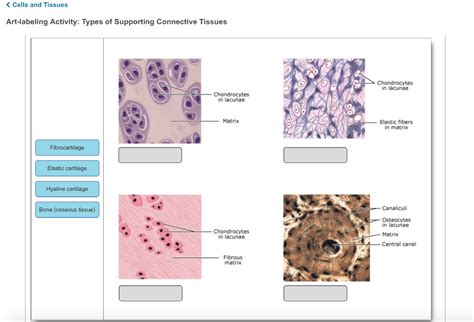 Hyaline Cartilage Connective Tissue Labeled