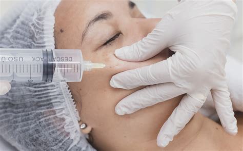 GIH Alves Estética Ozonioterapia