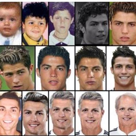 Sintético 105 Foto Cristiano Ronaldo Antes Y Después De Las Cirugías