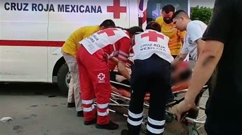 Mujer Sufre Fractura Expuesta Tras Ser Arrollada En Moto Por Auto En