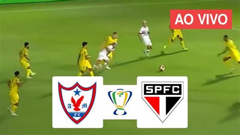 Onde assistir Águia Marabá x São Paulo ao vivo escalações e tudo sobre