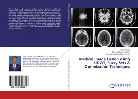 pdf medical image fusion using udwt fuzzy sets and optimization techniques