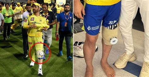 Chennai Super Kings CEO Opens Up On MS Dhonis Knee Injury Cricshadow