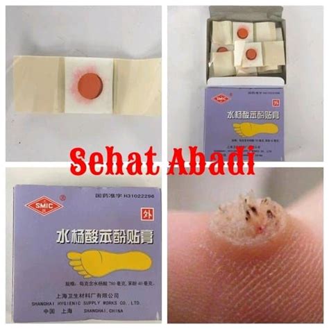 Jual Obat China Cina Plester Kutil Ji Yan Gao Obat Kutil Dan Mata