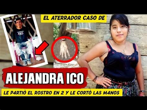 Le PARTlÒ el R0STR0 en 2 y AG0NIZÒ 30 minutos El Caso de Alejandra