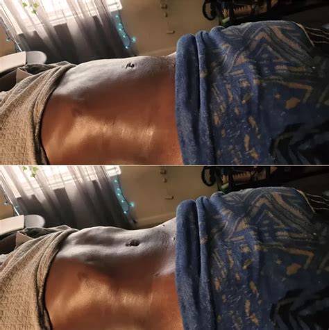 Maderoterapia antes y después Fotos de los cambios en el cuerpo