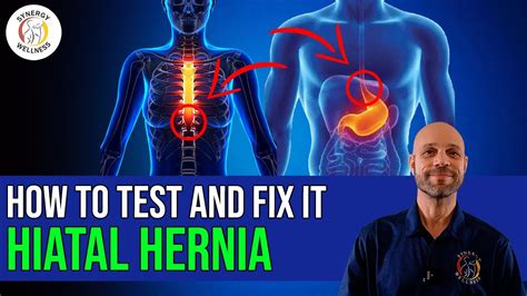 How To Test For Hiatal Hernia And Fix It YouTube