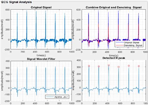 denoising signal ecg for normal download scientific diagram