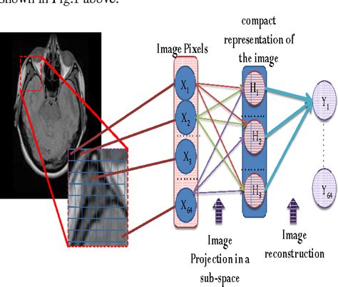 figure 1 from an enhencment medical image compression algorithm based on neural network