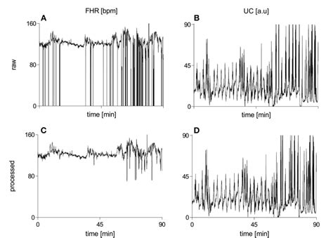 a strategy for classification of “vaginal vs cesarean section” delivery bivariate empirical