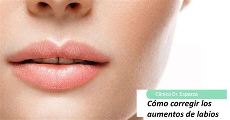 Cómo corregir los aumentos de labios Dr Esparza