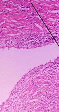 Urinary2