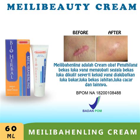 Jual Salep Penghilang Bekas Luka Hitam Jerawat Koreng Dan Keloid Cream