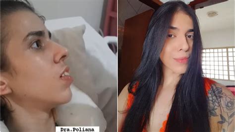 Jovem que passou mal após cheirar pimenta responde a estímulos durante