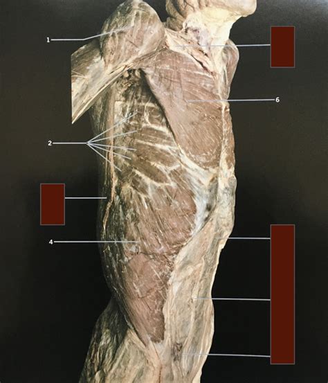 Superficial Muscles Of The Trunk Lateral View Diagram Quizlet